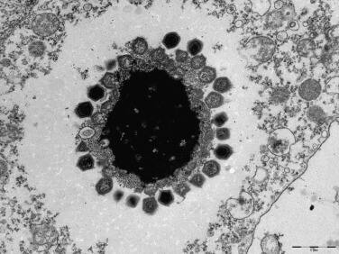 e3arabi - إي عربي – فيروس زاملون